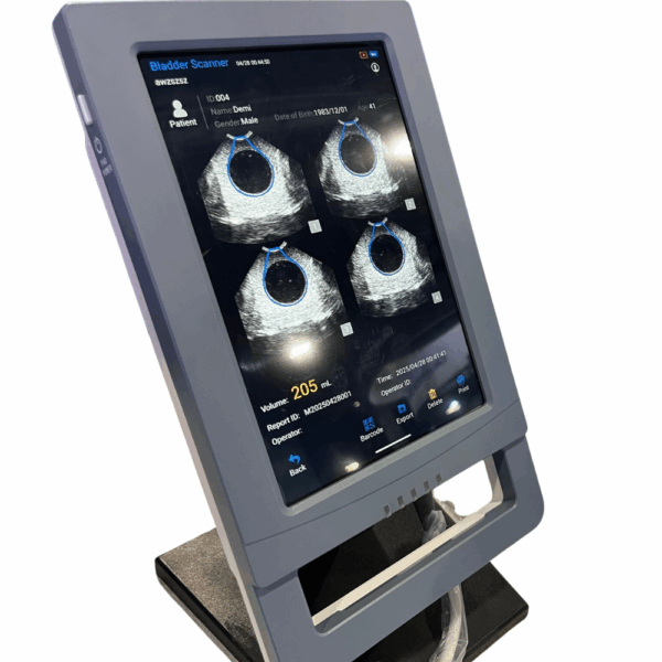 VioScan Portable Bladder Scanner - Infinium Medical