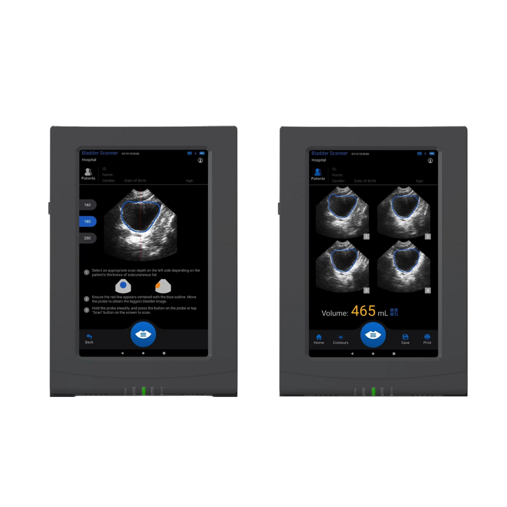 VioScan Portable Bladder Scanner - Infinium Medical