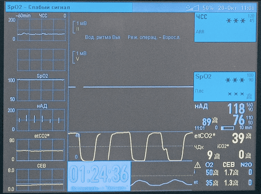 How to Read and Interpret Capnography Waveforms - Infinium Medical