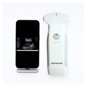 VioScan Portable Bladder Scanner - Infinium Medical