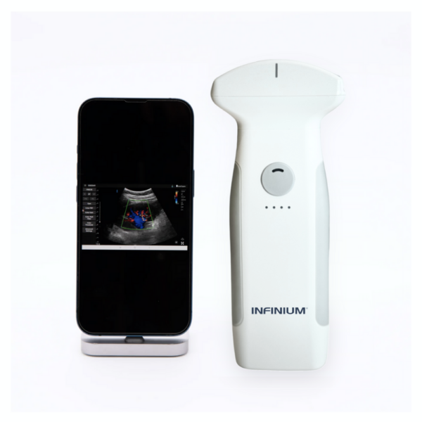 VioScan L2 - Wireless Handheld Linear Ultrasound - Infinium Medical