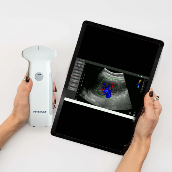 VioScan Portable Bladder Scanner - Infinium Medical