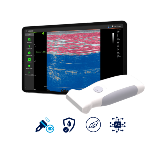 VioScan L2 - Wireless Handheld Linear Ultrasound - Infinium Medical