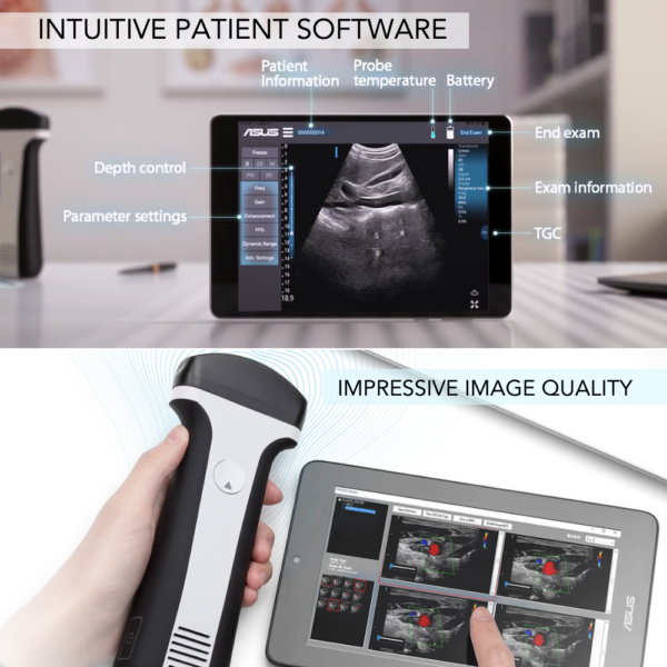 VioScan Portable Bladder Scanner - Infinium Medical
