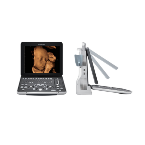 Portable Ultrasounds - Infinium Medical